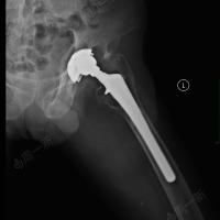 thomas征,tos,o布兰度_大山谷图库